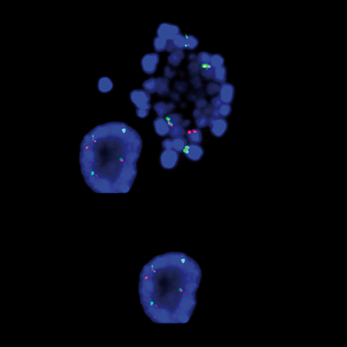 IVD KMT2A/MLLT4 - ISH Probes - Molecular Pathology