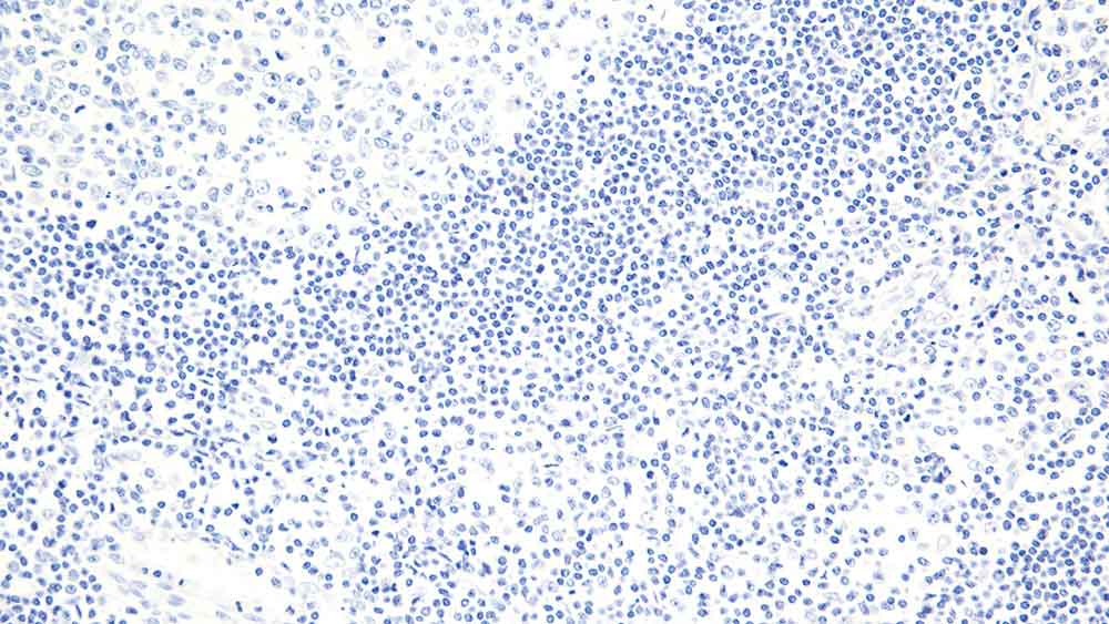 Negative Control - IHC Primary Antibodies