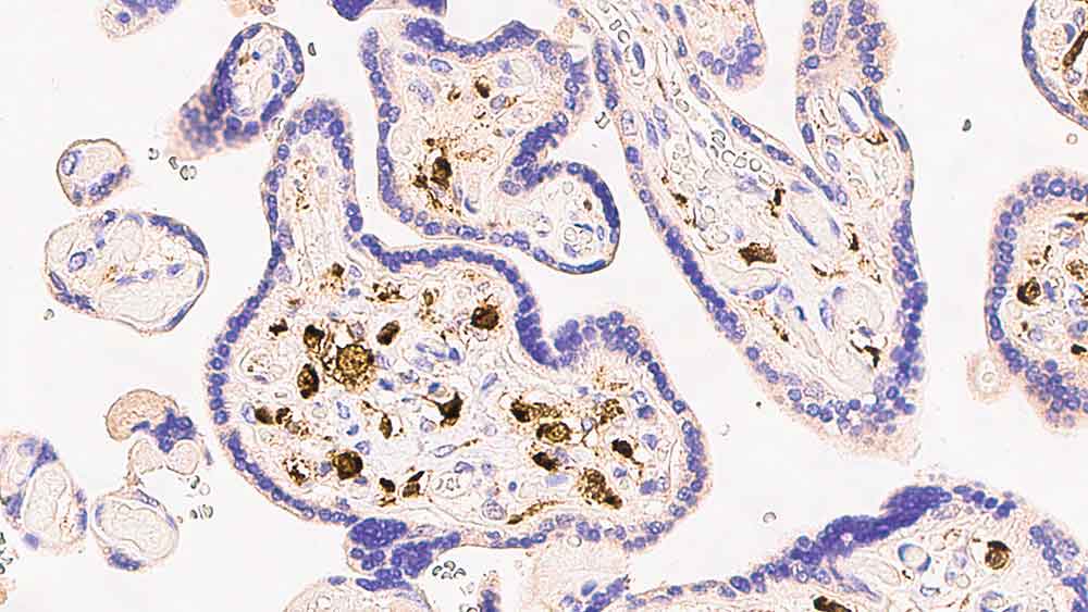 Factor XIIIa - IHC Primary Antibodies